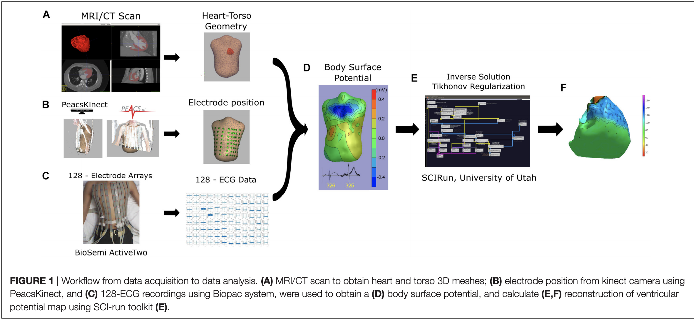 Mechanisms of Arrhythmogenicity in Hypertrophic Cardiomyopathy: Insight ...